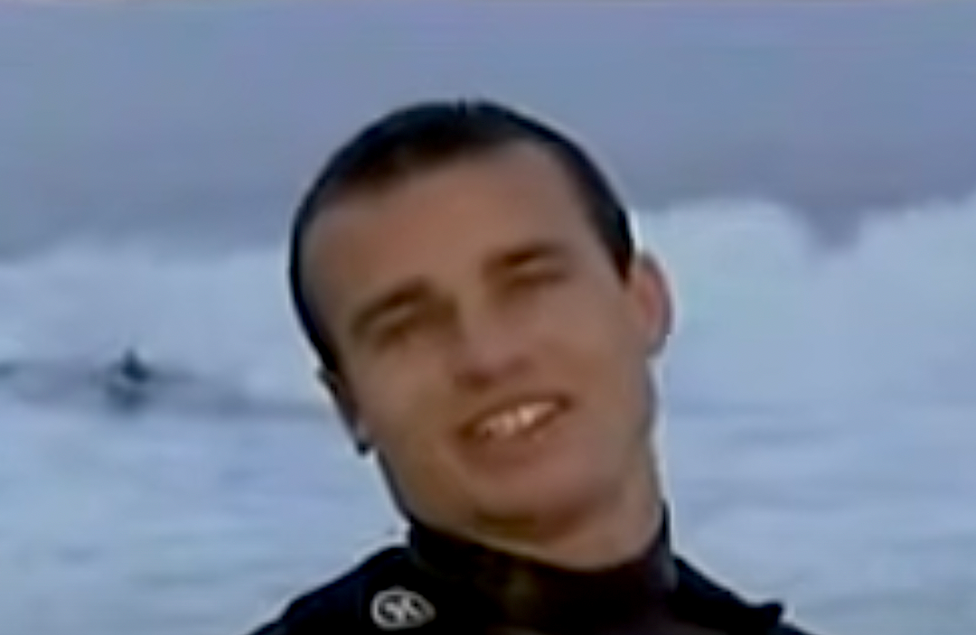 Viral 'Surfer Dude' Hospitalized in Freak Accident (Video) - Surfer