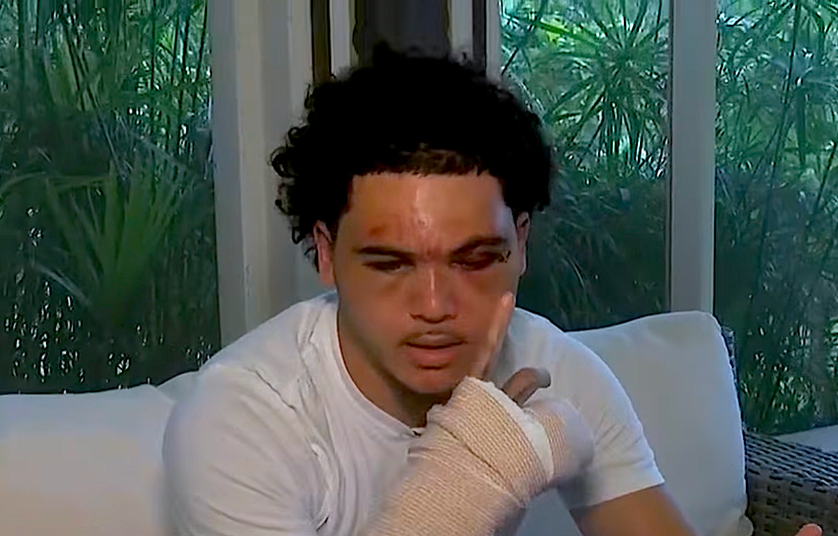Lifeguard Beaten by Mob on Oahu's North Shore (Video) - Surfer