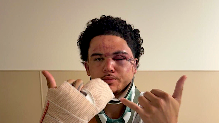 Teens Arrested in Brutal North Shore Oahu Gang Fight - Surfer