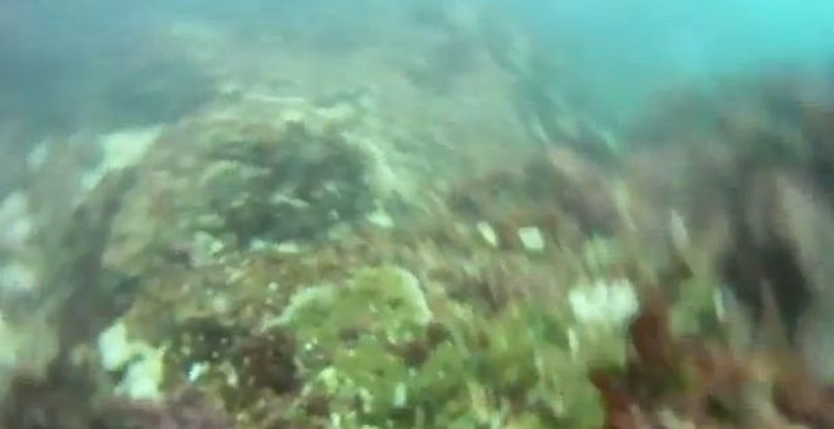 Worst Reef Rash Ever - Surfer