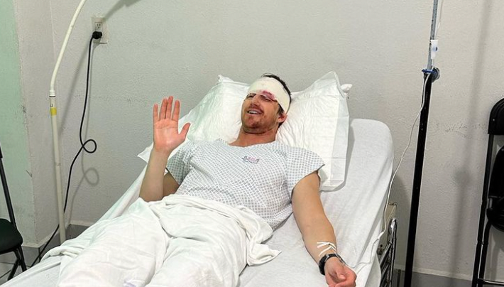 Big-Wave Surfer Matt Bromley Speared in the Head by Board at Puerto ...
