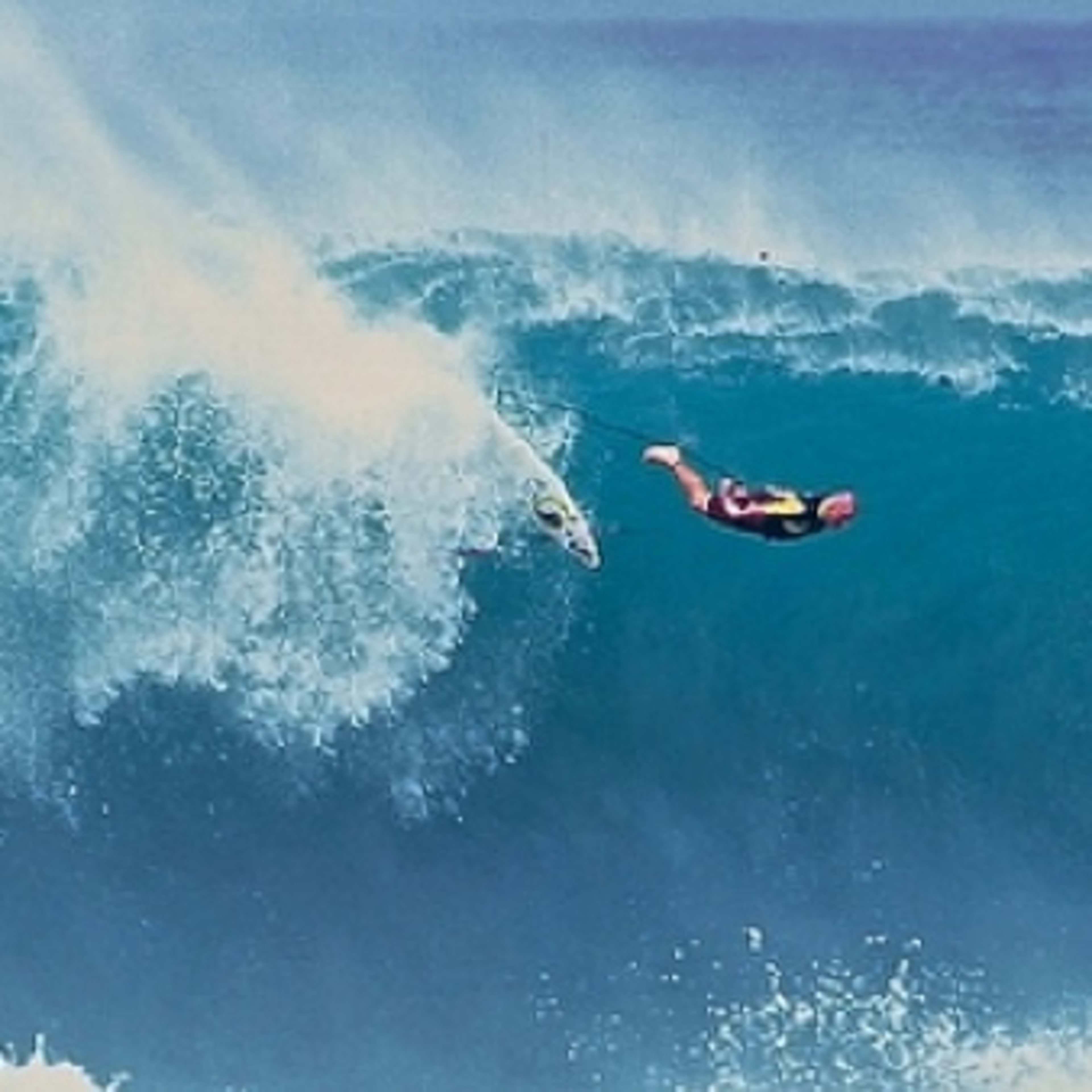 Son of Iconic Surfer Remains in Coma After Freak Car Accident - Surfer