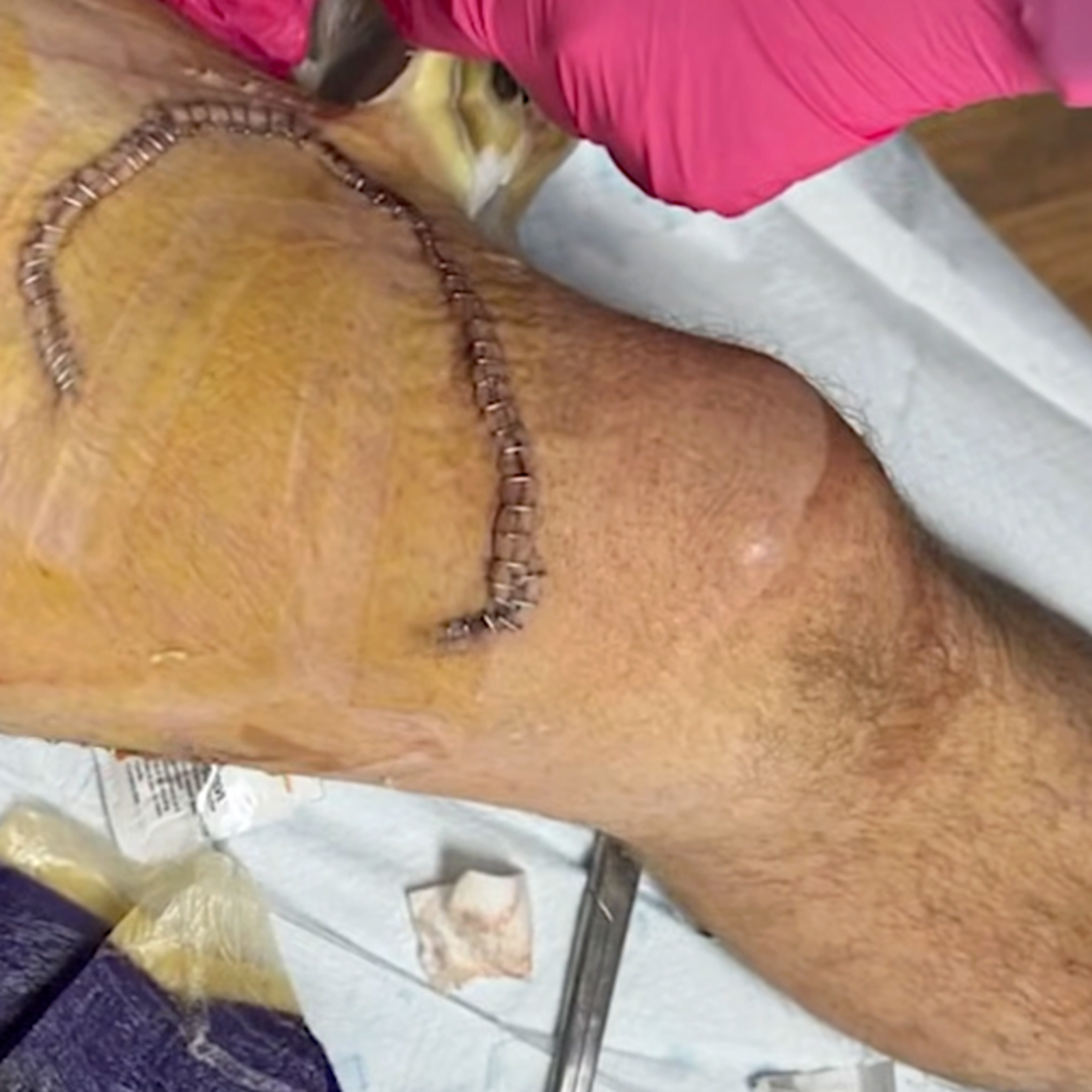 Fact Check: Do Cows Kill More Humans Than Sharks? - Surfer