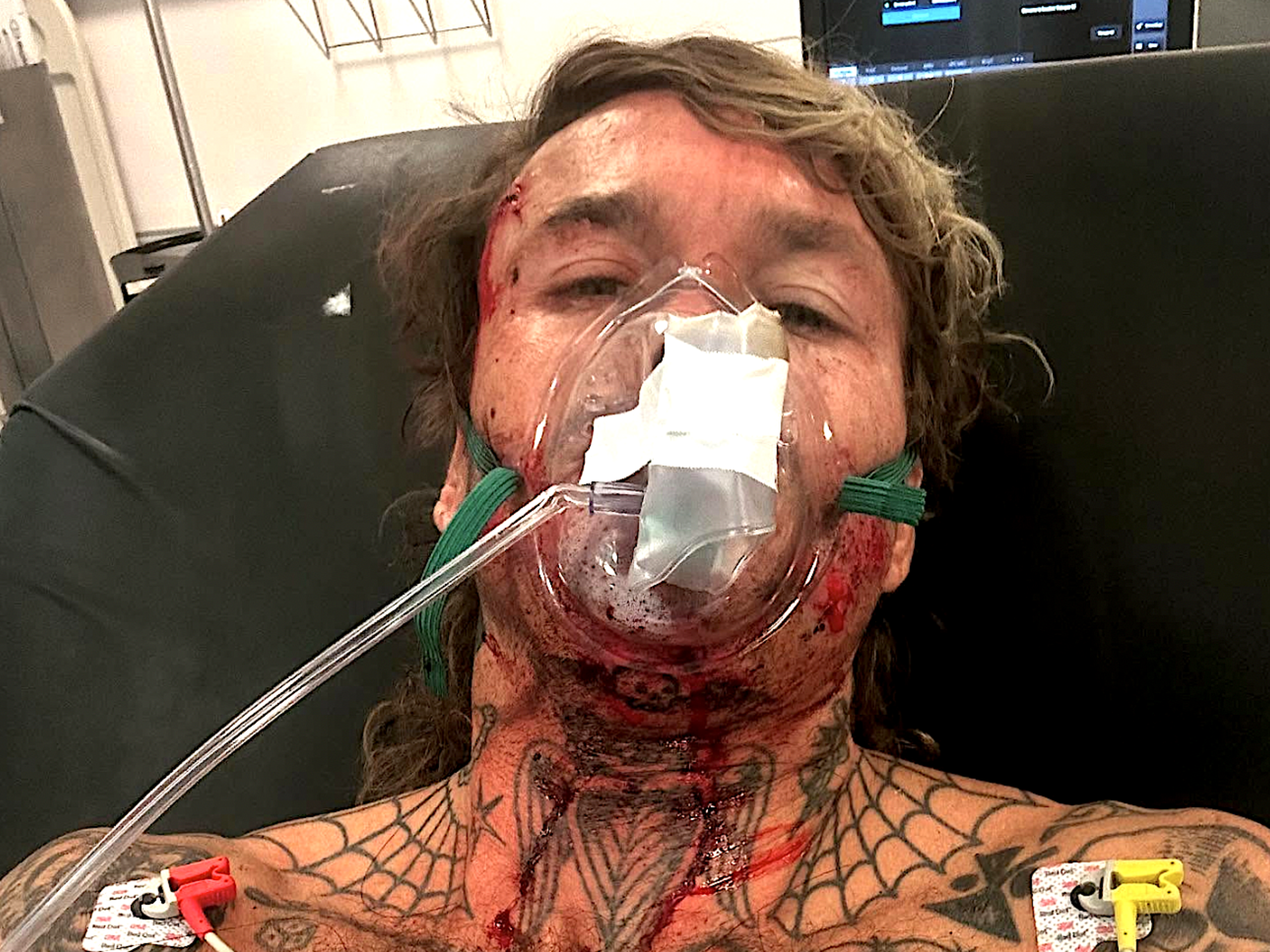 Tom Lowe Recounts Near-Death Wipeout at Teahupo’o - Surfer