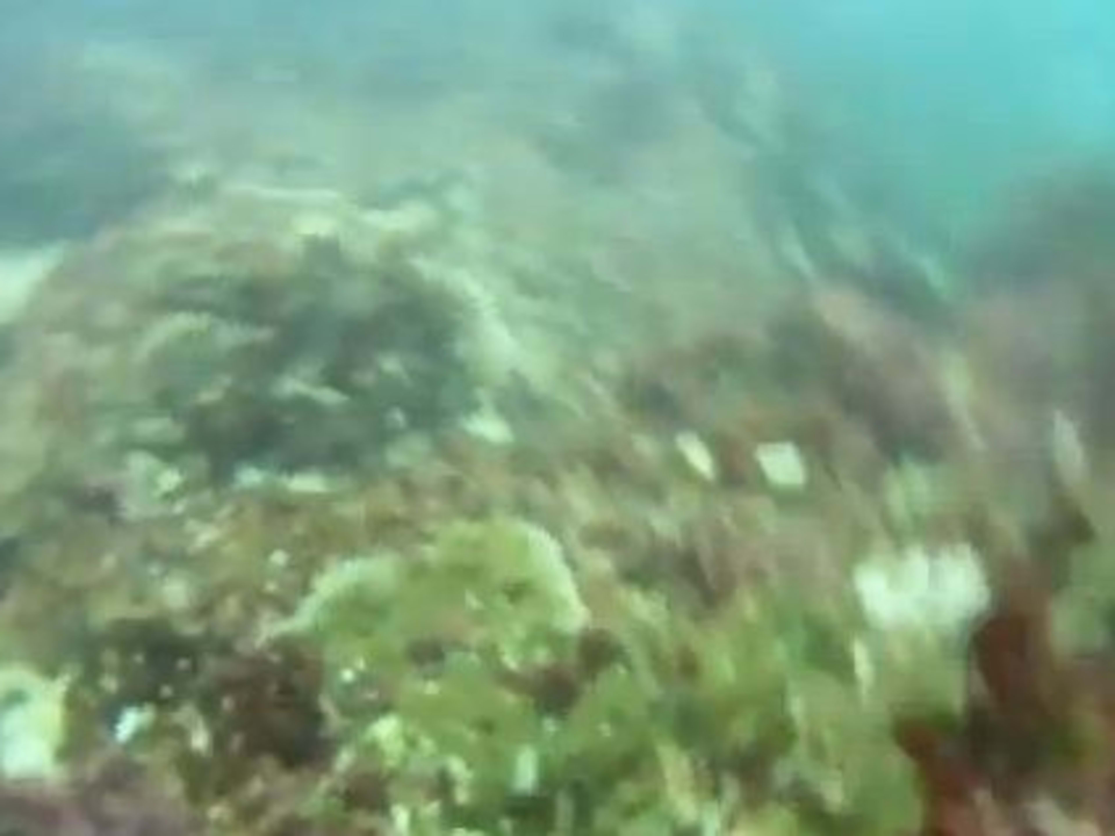 Worst Reef Rash Ever - Surfer