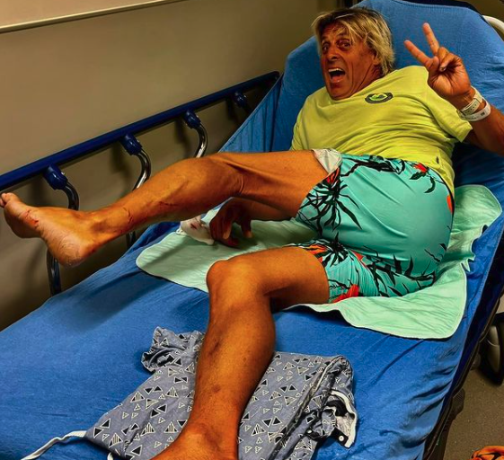 Florida Legend “Gnarly” Charley Hajek Bitten by Shark While Surfing in ...