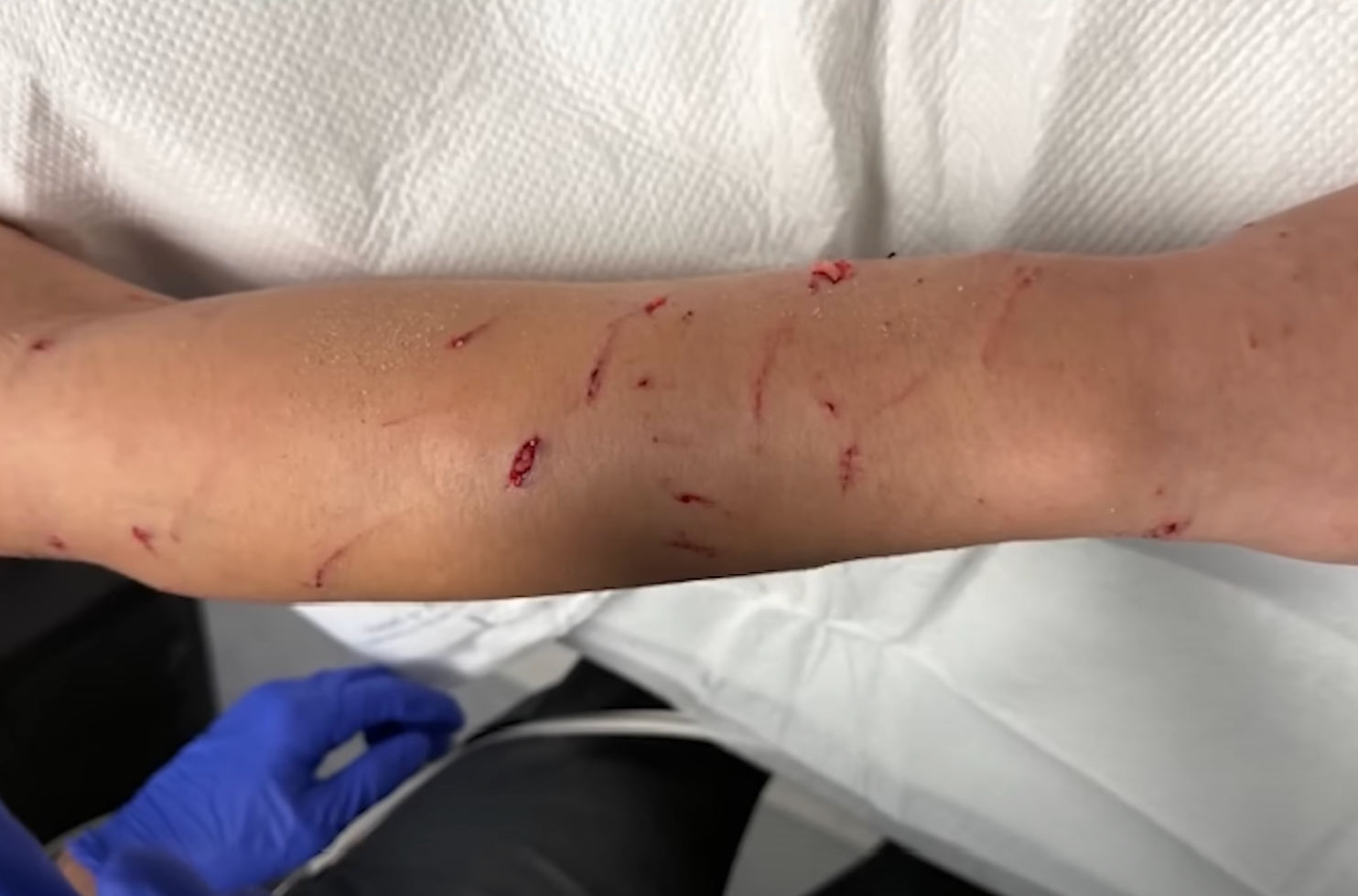 Sea Lion Attacks Teenage Girl in Long Beach (Video) - Surfer