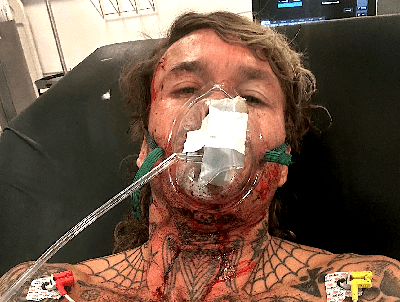 Tom Lowe Recounts Near-Death Wipeout at Teahupo’o - Surfer